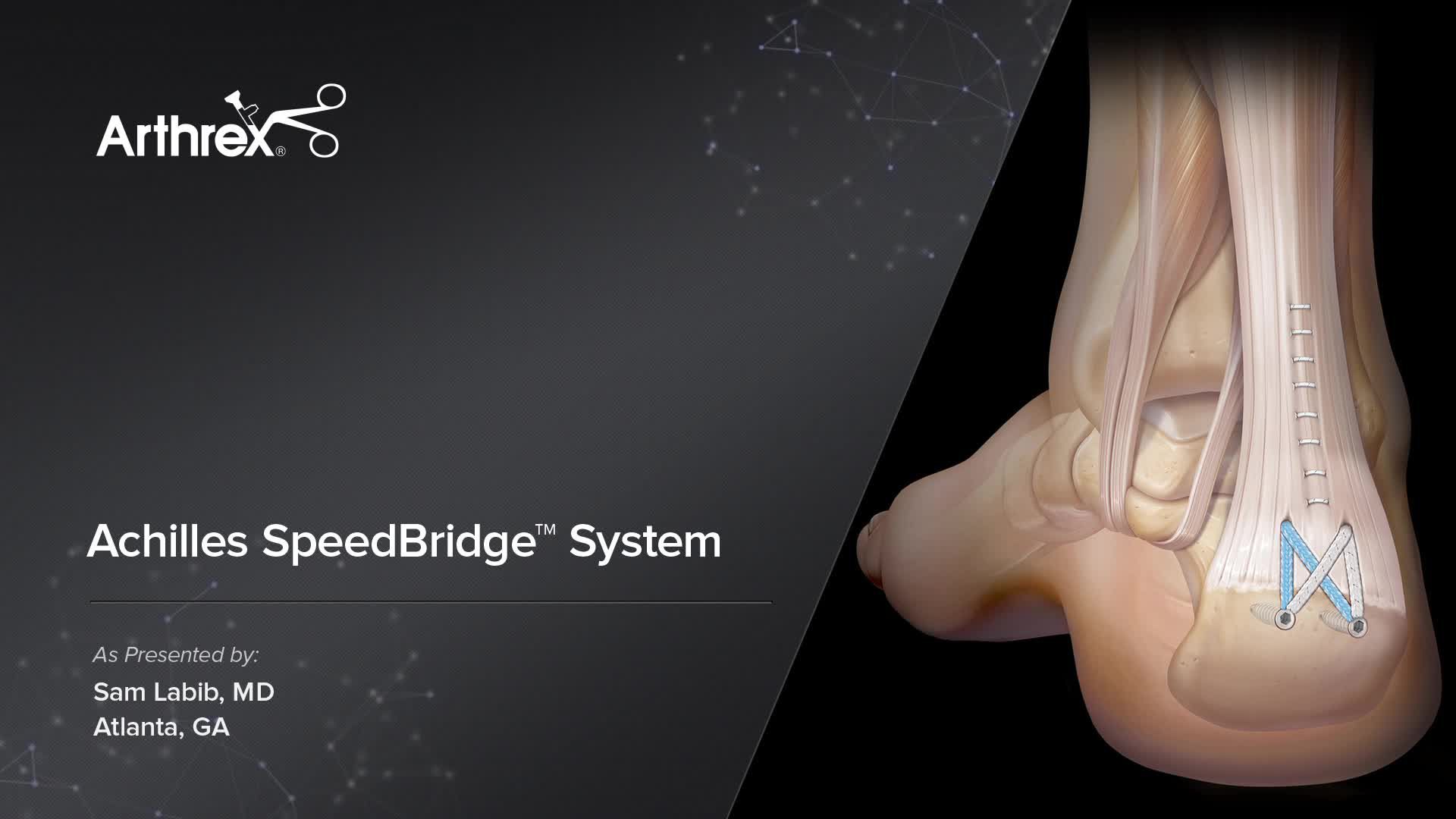 Komplexe Revisionschirurgie der Achillessehne (mit Eigen- und ...